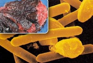 Clostridium Chauvoei Archives - Notiagro